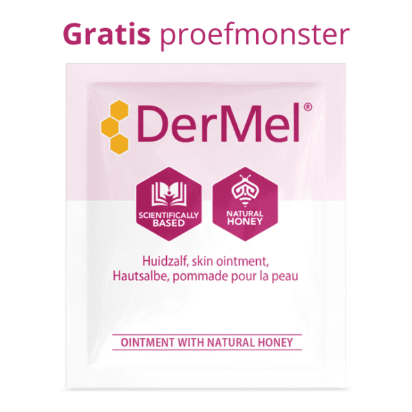 Geïrriteerde huid - DerMel